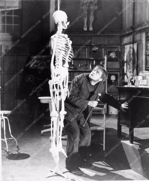 Dwight Frye as Igor horror film Frankenstein 1851-18 – ABCDVDVIDEO