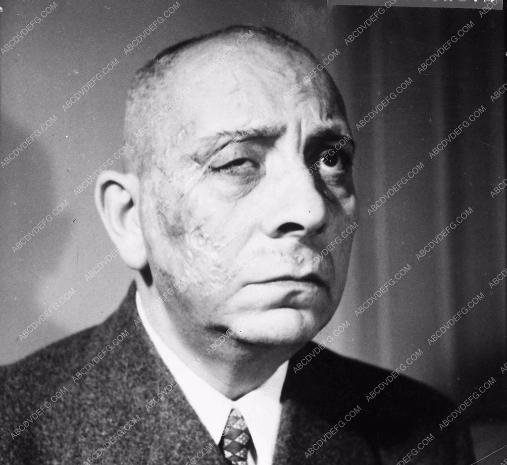 Erich Von Stroheim Scarred Up Horror Film 4197 04 Abcdvdvideo